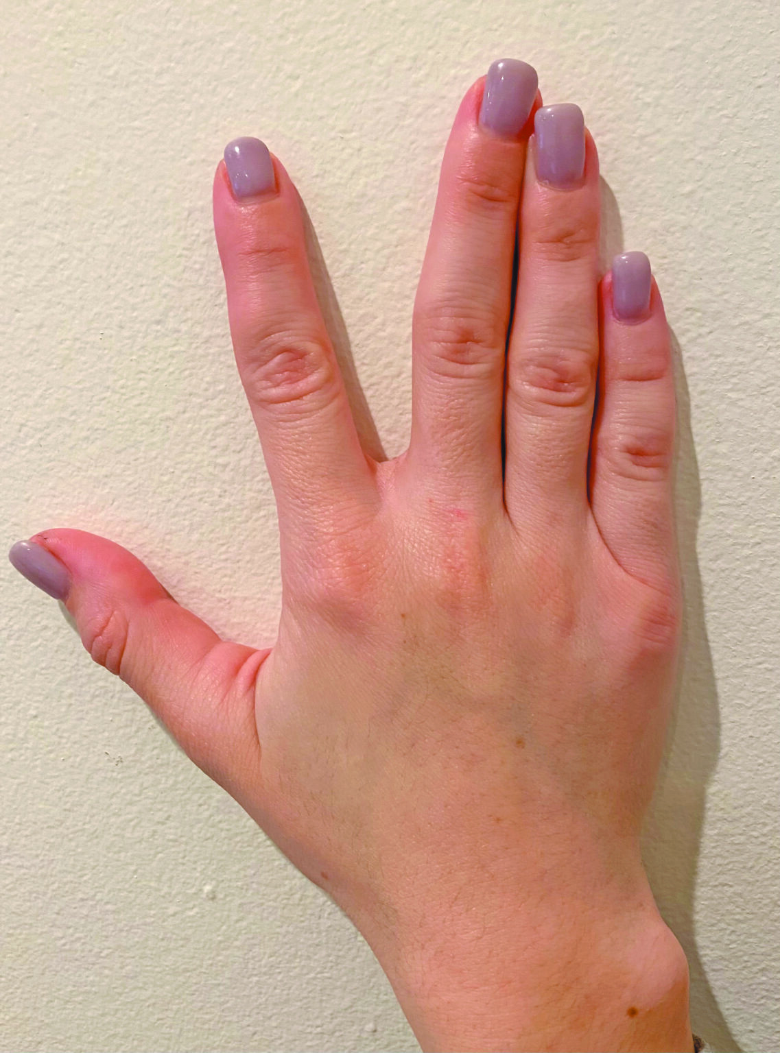 Show Your Hands Some TLC | Bottom Line Inc