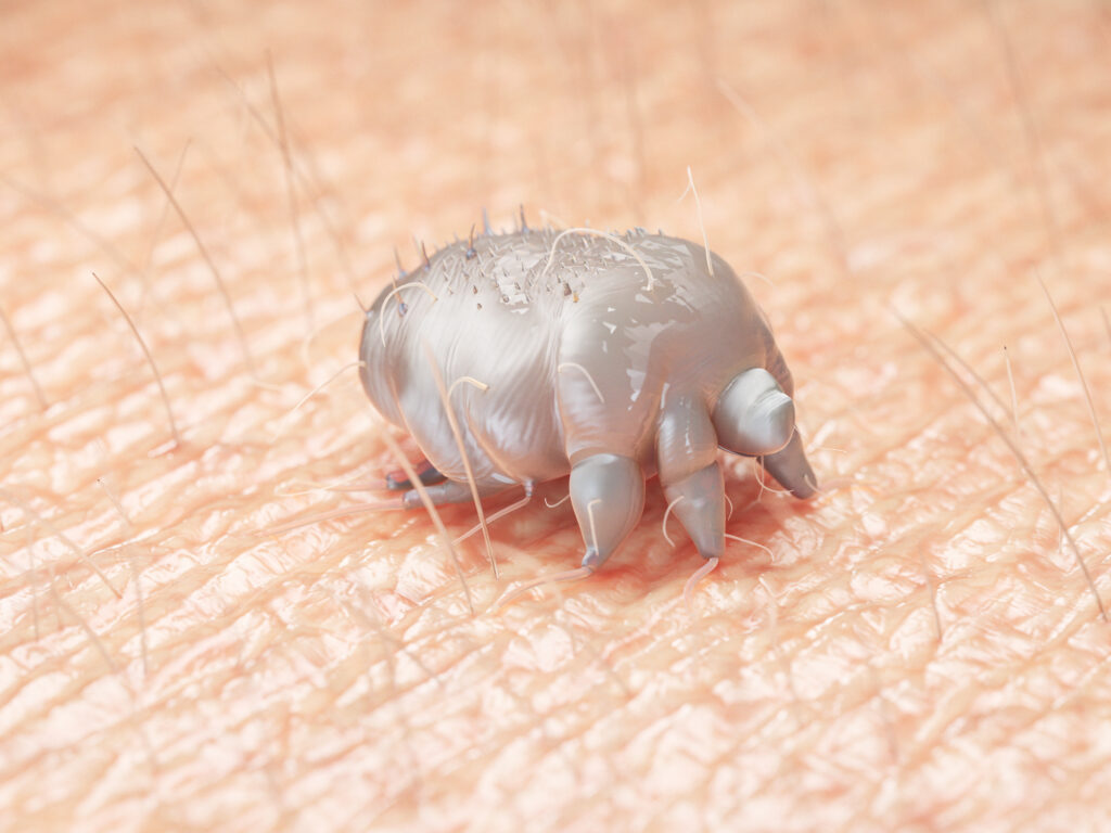 How to Identify Scabies | Bottom Line Inc